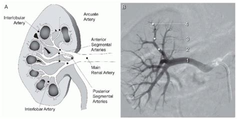 Renal Arterial Anatomy Radiology