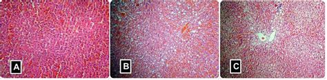 Histopathological Evaluation A Absence Macrovesicular Steatosis H E