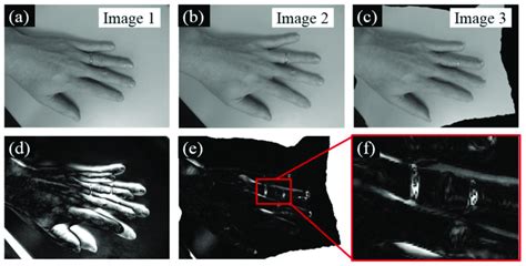 Demonstration Of Intensity Based Image Registration Through An Example Download Scientific