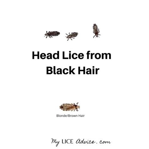 Top 150 Bugs In Hair But Not Lice Polarrunningexpeditions