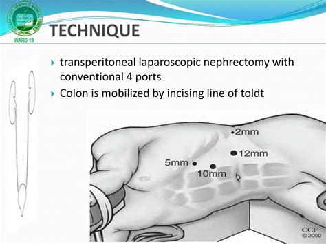 Lap Nephrectomy Case Ppt Pptx