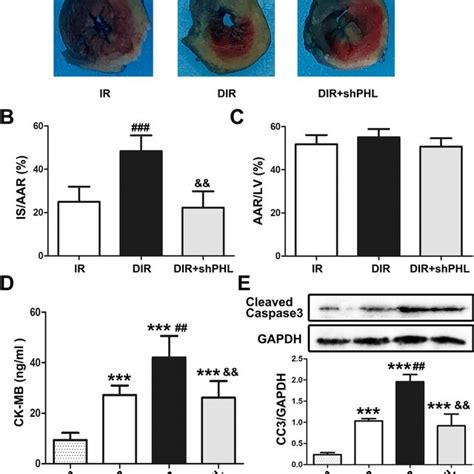 Myocardial Ischemiareperfusion Ir Injury In Vivo A Heart Sections