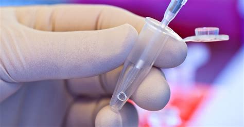 ‘rapid Dna A Breakthrough For Solving Crimes Some Say Not So Fast