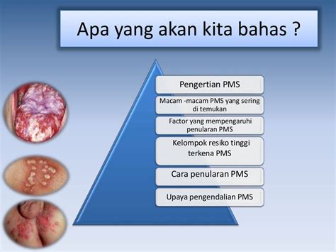 Penyakit Menular Seksual