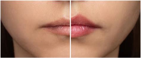 Cara Bikin Lip Balm Untuk Cerahkan Bibir Hitam Pakai 1 Jenis Bunga