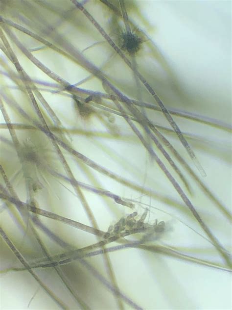 Algae Microscopy Macroscopy Photos Videos And Journals Care
