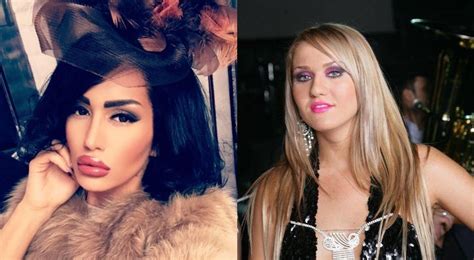 Topul vedetelor din RomÃnia care au plÄƒtit averi pe operaÈii estetice AflÄƒ cine este pe