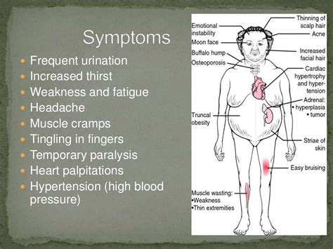Conns Syndrome Group Project