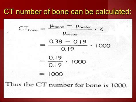 Basics Of Ct Lecture 2