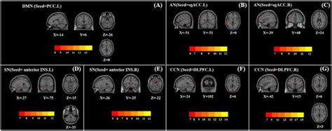 Dr Zohreh Majd On Linkedin Distinct Patterns Of Functional Brain Network Integration Between…