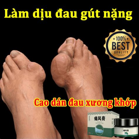 Kem Bôi Gout 35g Giảm đau Gút Khớp Kem Giảm đau đầu Gối đau Khớp Sỏi