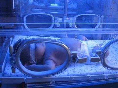 心痛婴儿出生后8天内因黄疸死亡新手父母一定要警惕 健康家园 广东医科大学顺德妇女儿童医院
