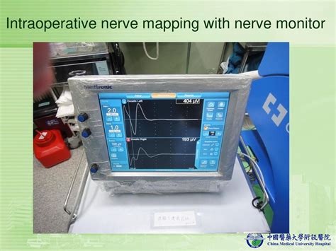 經雙側腋下、乳房行甲狀腺切除術 ─中國附醫經驗分享 Baba Procedure In Cmuh Ppt Download