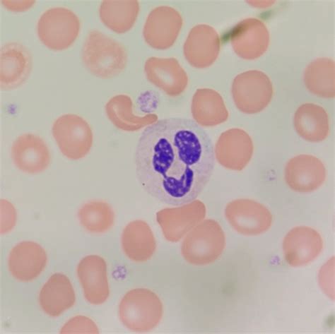 Segmented Neutrophils Identification And Differentiation