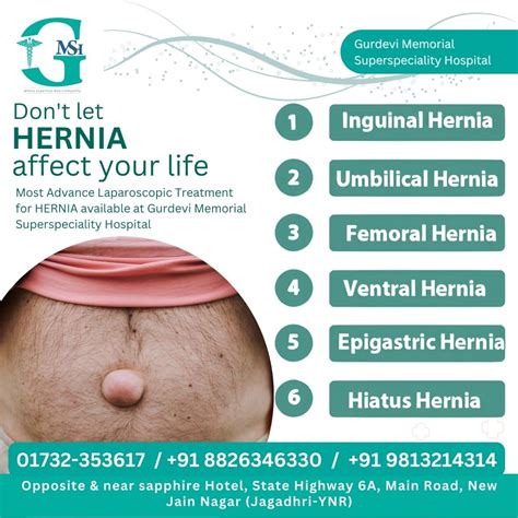 Hernia Operation In Yamunanagar For Safe And Affordable Treatment