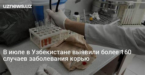 Uznews В июле в Узбекистане выявили более 160 случаев заболевания корью