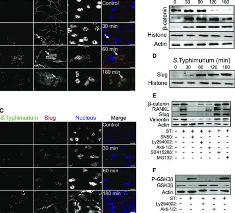 S Typhimurium Activates Wntb Catenin Signaling Fac Epithelial Cells
