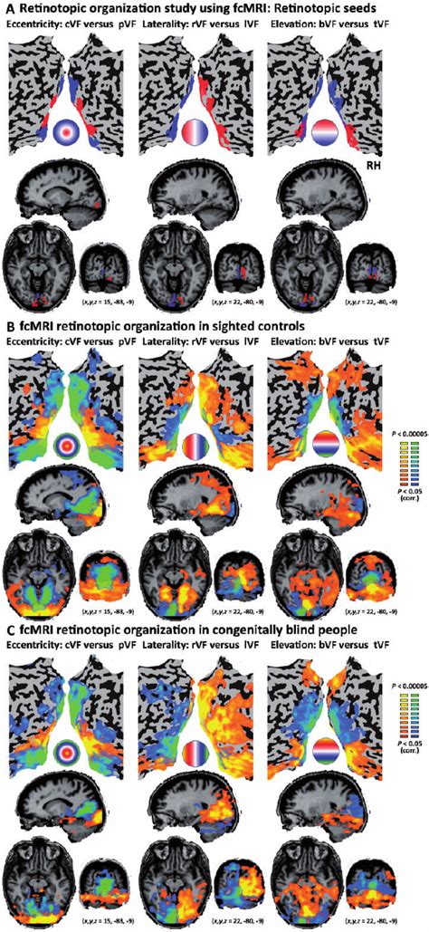 Resting State Functional Connectivity Mri Retinotopic Organization In Download Scientific
