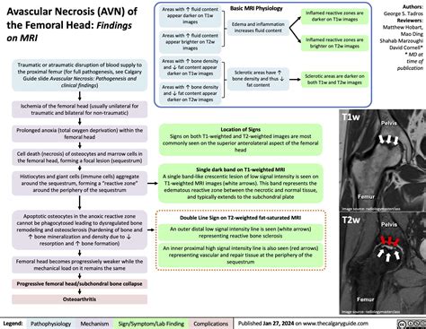 Avascular Necrosis Avn Of The Femoral Head Findings On Mri Calgary