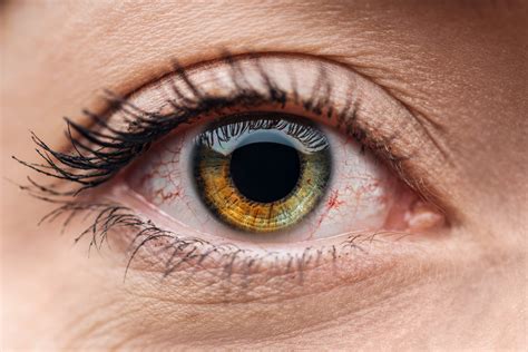 Botox For Bags Under Eyes Med Spa Insider Secrets By Aylin