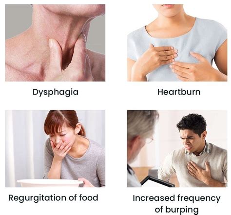 Esophageal Stricture Medical Junction
