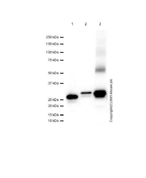 Recombinant Human Rab5a Protein Ab62956 Abcam