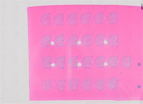 Imagej Cell Counting Automation He Stain Nuclei Image Analysis