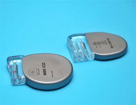 Implantable Defibrillator Icd Cardiac Services St Vincents Private Hospitals