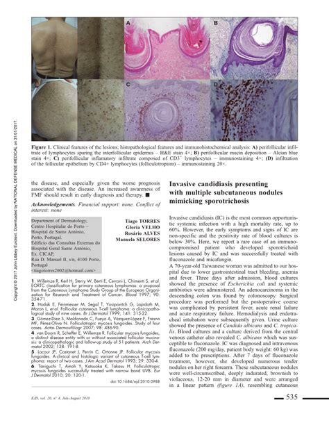Pdf Invasive Candidiasis Presenting With Multiple Subcutaneous Nodules Mimicking Sporotrichosis
