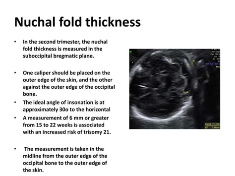 Fetal Anomaly Scan Ppt