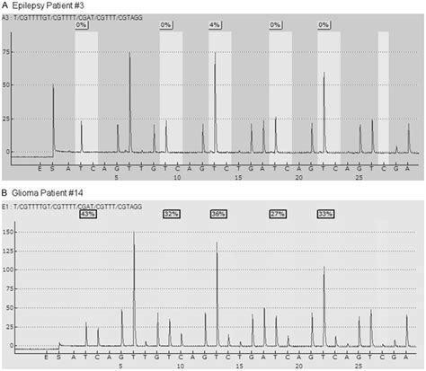 Detection Of Mgmt Promoter Methylation In Glioblastoma Using