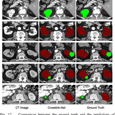 Figure 12 From Crosslink Net Double Branch Encoder Network Via Fusing