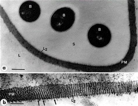 Formation And Ultrastructure Of The Peritrophic Membrane In Larval
