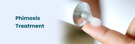 Phimosis Treatment Options For Relief And Recovery