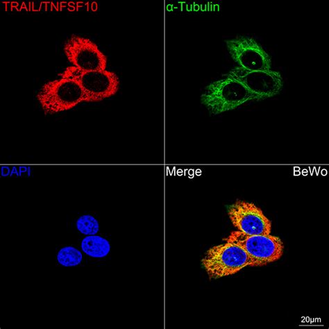 Trail Tnfsf10 Rabbit Mab Monoclonal Antibodies Abclonal