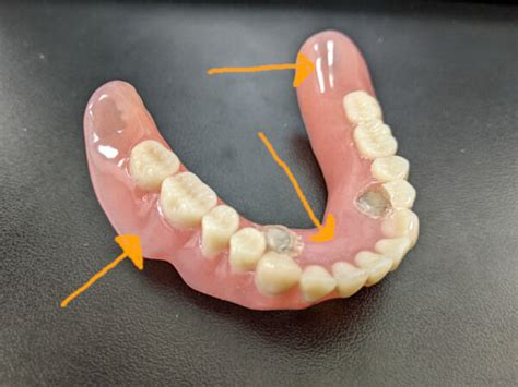 Denture Gum Shade Guide Images Videos And How To Use 1311 Jackson Ave