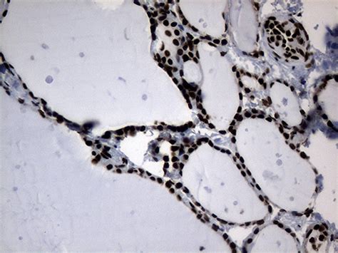 Anti Polr2a Rna Polymerase Ii Antibody Mouse Anti Human Ihcwb Lsbio