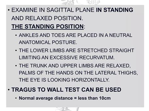 Thoracic Kyphosis Thoracic Hyperkyphosis Pptx Death Injury Or