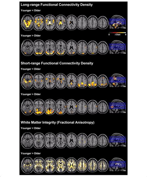 Regional Differences Between Age Groups In Short And Long Range Fcd
