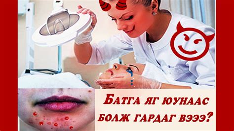 Гоо сайханч батганы талаар САЙН МЭДДЭГГҮЙ Батга ЯГ юунаас болж гардаг