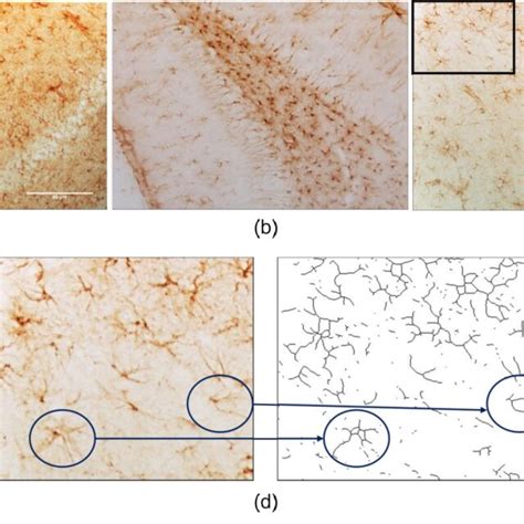 Dab Stained Gfap Ihc Photomicrographs Acquisition With 20×