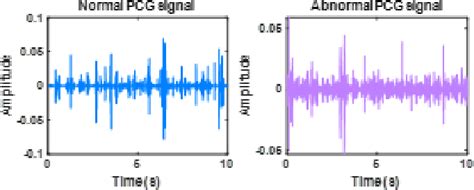 Figure 1 From Classification Of Cardiovascular Disease Using 2d Image Representations Of