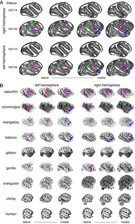 Anatomical Correlates Of Face Patches In Macaque Inferotemporal Cortex