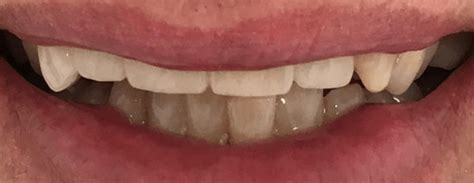 Dentist Melbourne Cbd Zen Smiles