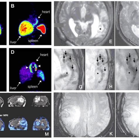 Schematic Of Common Imaging Approaches For Tracking Stem Cells In Vivo