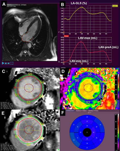 The Feature Tracking Analysis Of The Left Atrium And Assessment Of Left Download Scientific