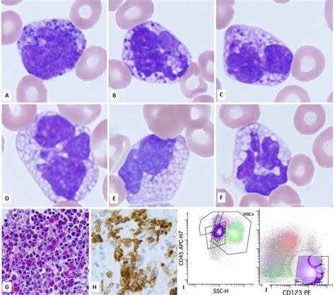 Basophils