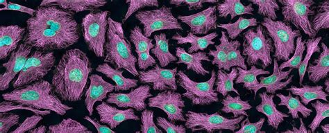 Over 30000 Published Studies Could Be Wrong Due To Contaminated Cells