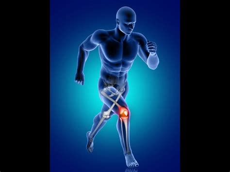 Exercises To Avoid ACL Tears