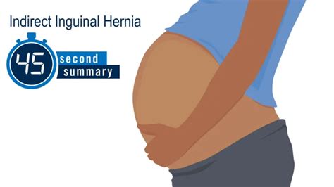 Inguinal Hernia Pregnancy